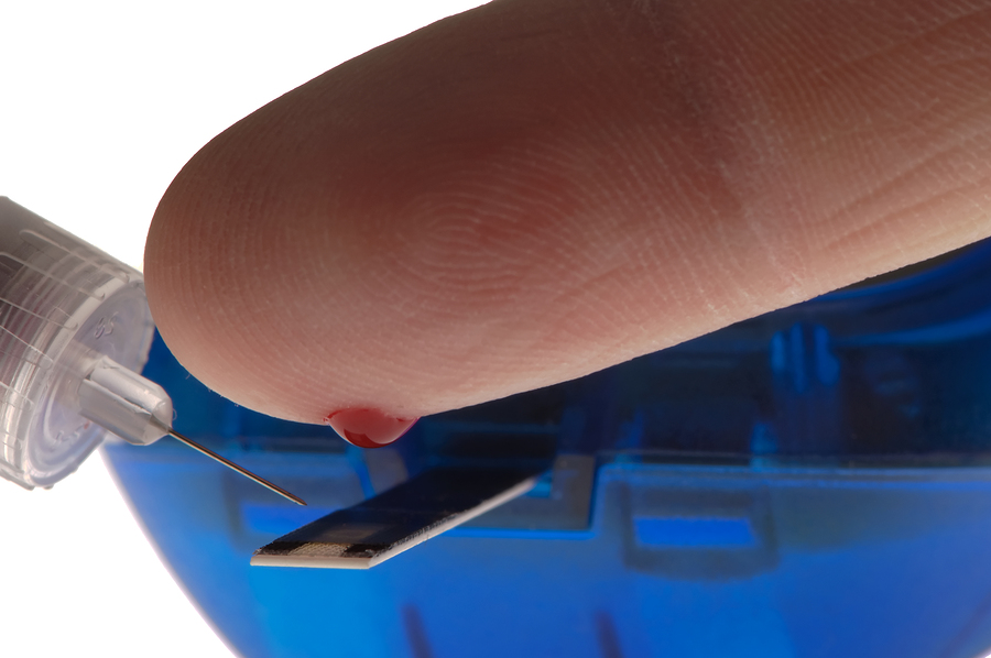 Insulin Resistance Test Insulin Resistance Test